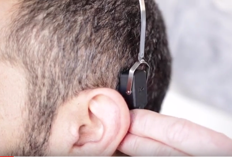 Bone vibrators in general – ortofon-microtech